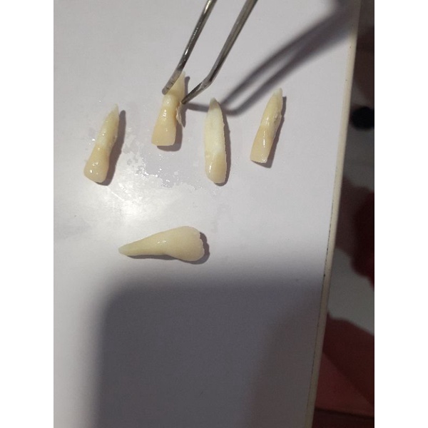 Jual gigi insisivus bawah non caries. Ready .. limited!! | Shopee Indonesia