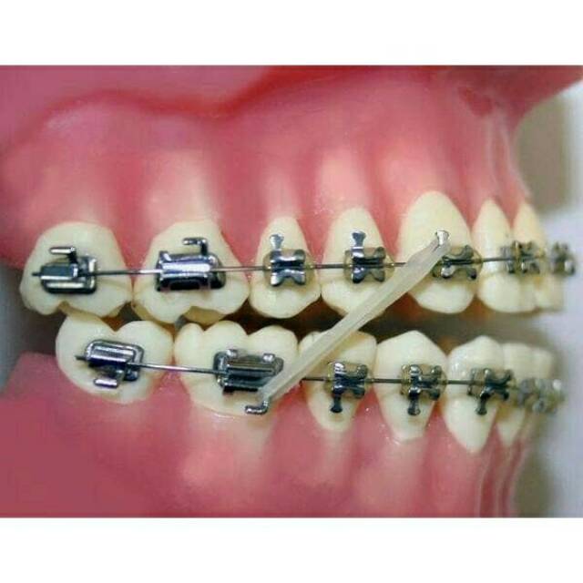 Jual Rubber elastics / karet gigi elastic | Shopee Indonesia