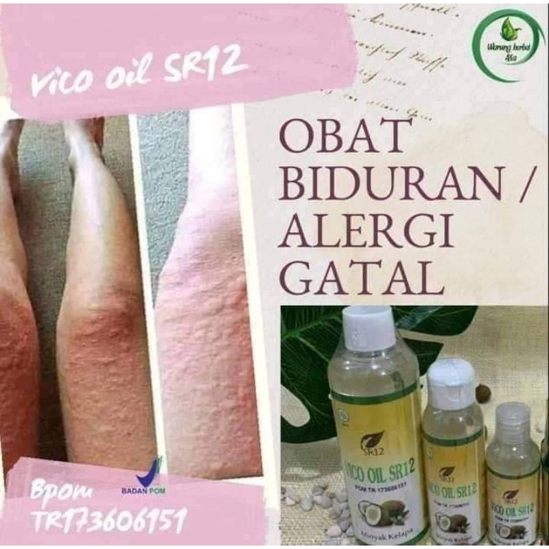 Jual OBAT GATAL BIDURAN VICO SR12 PALING AMPUH/OBAT GATAL KULIT/OBAT ... Jual OBAT GATAL BIDURAN VICO SR12 PALING AMPUH/OBAT GATAL KULIT/OBAT ...