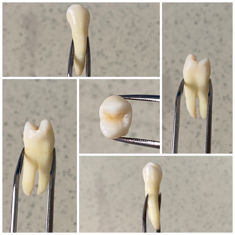 Jual Gigi Asli Premolar (P1 RA) | Shopee Indonesia