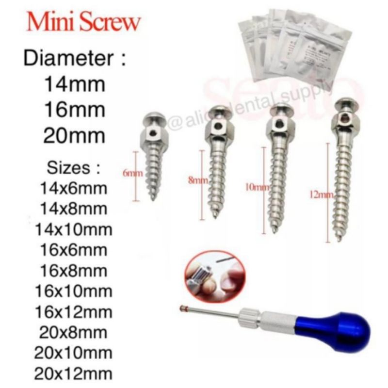 Jual mini screw implant ortodontik TAD 1.6x 8 mm | Shopee Indonesia