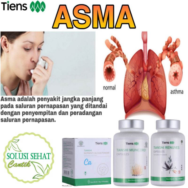 Jual Paket Asma Tiens / Obat Asma / Obat Sesak Nafas Herbal / Original ...