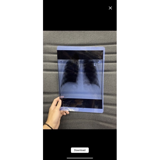 Jual kertas ronsen rontgen x ray xray a4 blue film | Shopee Indonesia