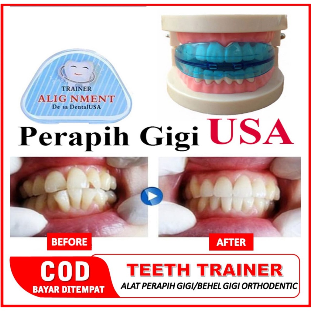 Jual PREMIUM Perapih Gigi Behel Teeth Trainer Alignment Original Perapi ...
