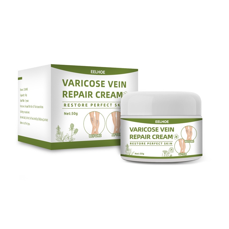 Jual Varicose Veins Treatment Cream Salep Vaskulitis Flebitis Spider ...