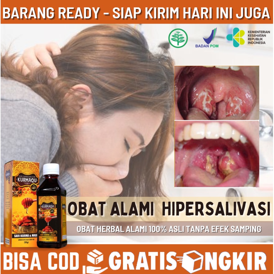 Jual Obat Alami Hipersalivasi, Obat Alami Penghilang Mual - Mual Untuk Ibu Hamil / Busui, Obat ...