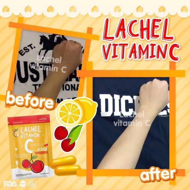 Jual LACHEL VITAMIN C VIT C ORIGINAL THAILAND | Shopee Indonesia