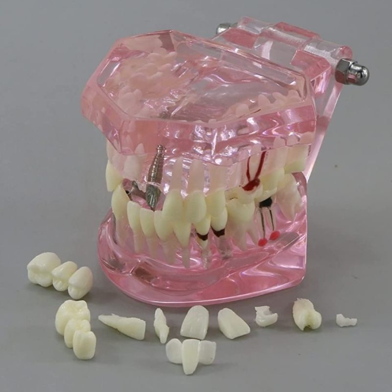 Jual model gigi /phantom gigi / Dental study model | Shopee Indonesia