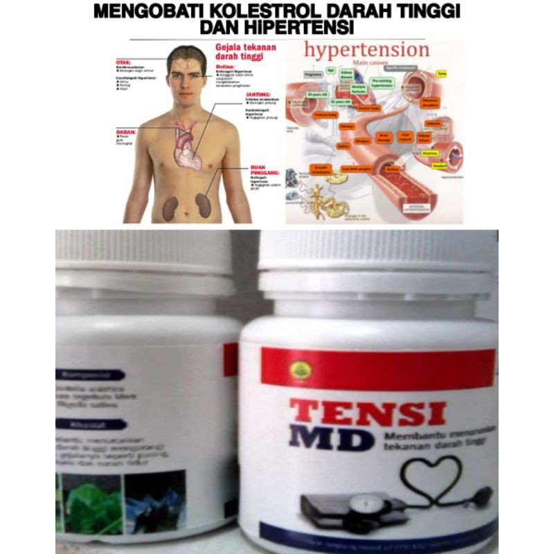 Jual OBAT KOLESTROL DARAH TINGGI DAN HIPERTENSI ASLI HERBAL LIFE ...