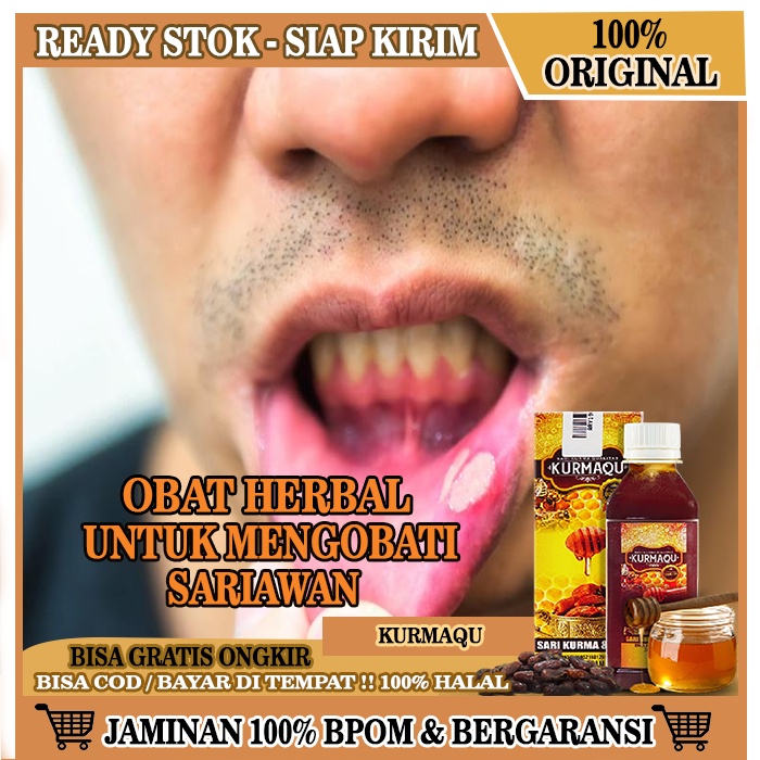 Jual Obat Sariawan Dan Panas Dalam Obat Herbal Sariawan Menahun Sariawan Di Lidah Sariawan Di