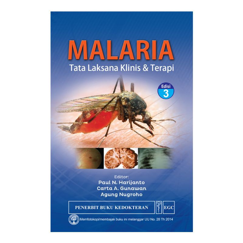 Jual Malaria Tatalaksana Klinis dan Terapi Edisi 3 | Shopee Indonesia