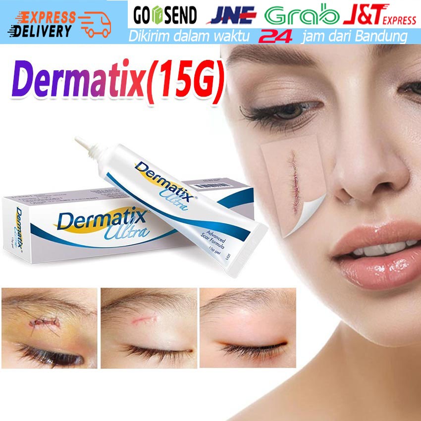 Jual Dermatik Ultra / Dermatic / Dermatix Ultra Advanced Scar Formula ...