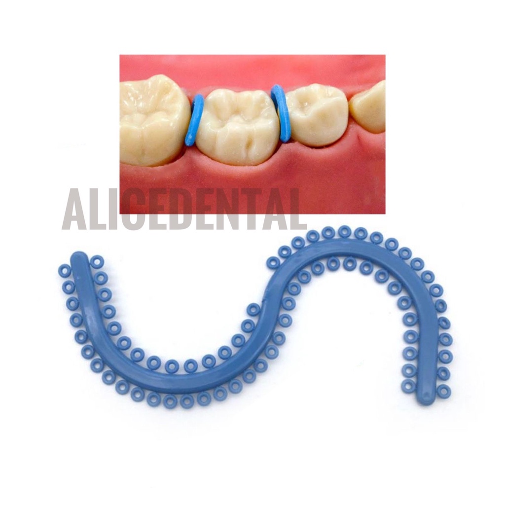 Jual Dental karet elastic separator molar band ring ortho orthodontic ... Jual Dental karet elastic separator molar band ring ortho orthodontic ...