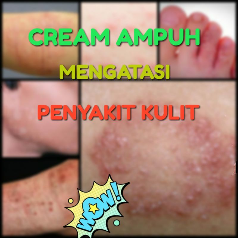 Jual SALEP GATAL OBAT GATAL CREAM GATAL RACIKAN MULTIGUNA MENGATASI ...