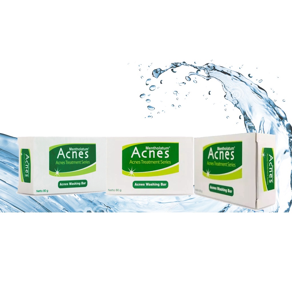 Jual Acnes Washing Bar 80 gr | Shopee Indonesia