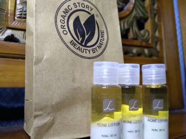 Jual Larissa ACNE LOTION | Ampuh hilangkan Jerawat | Shopee Indonesia