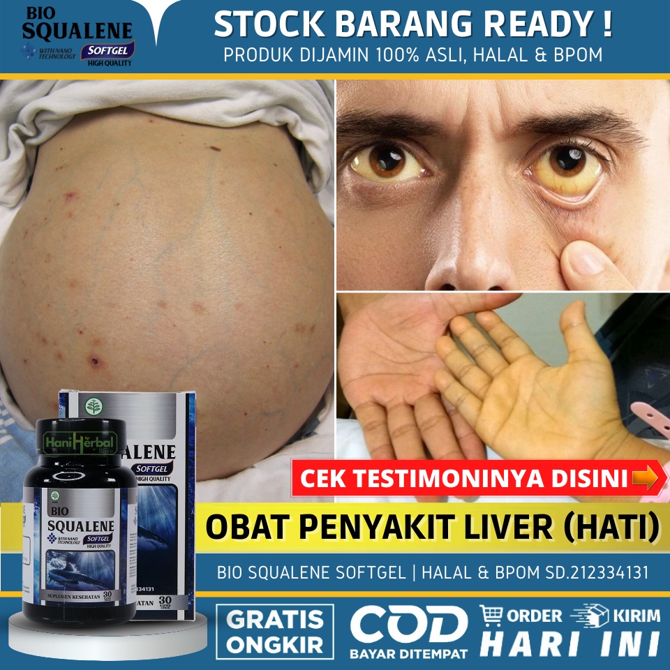 Jual Obat Herbal Untuk Sirosis Hati Akut / Kronis - Obat Penyakit ...