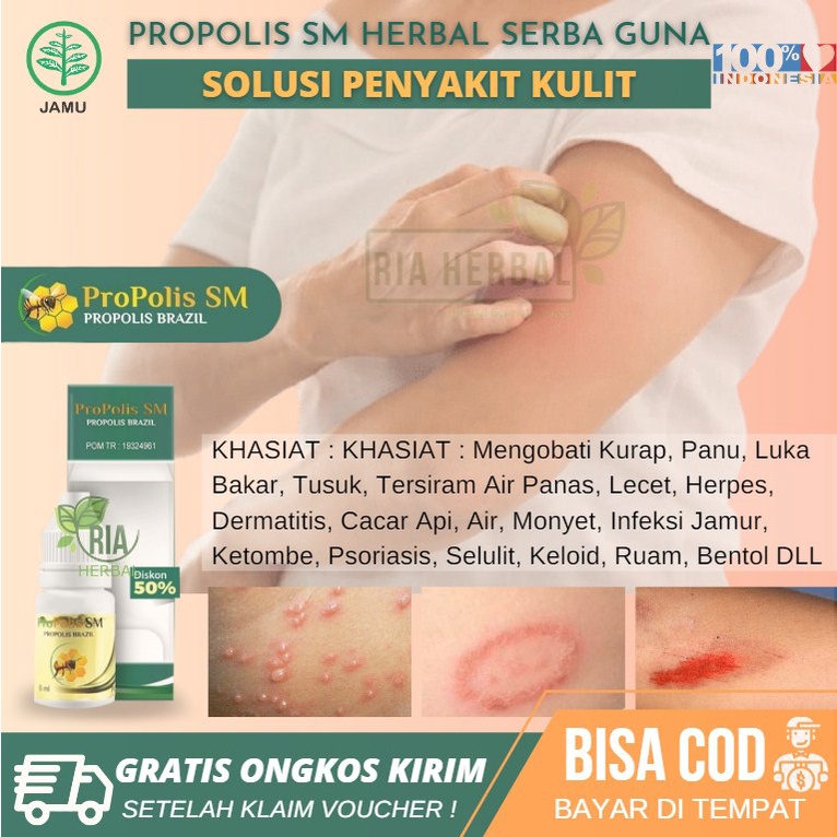 Jual Obat Gatal di kemaluan, Infeksi Jamur, HPV, HIV, Penyakit Kulit ...