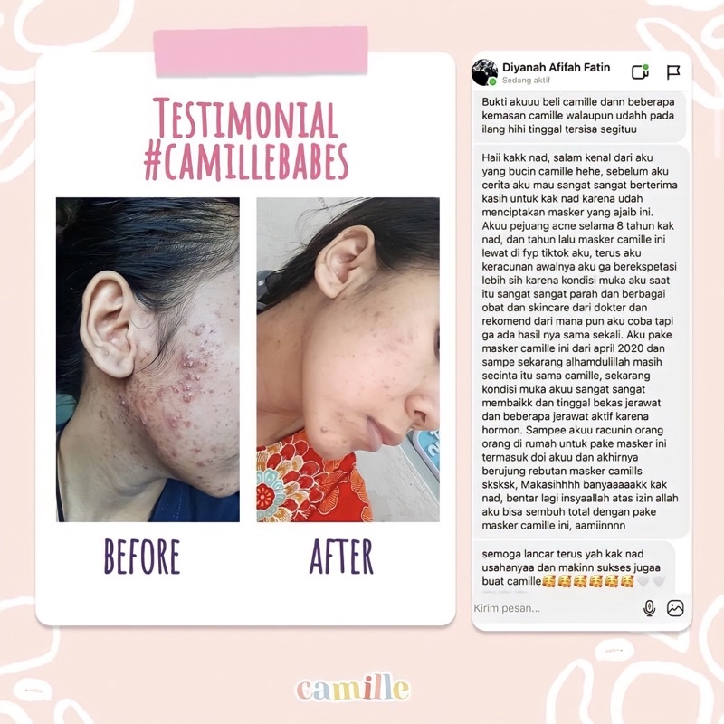 Jual Masker Camille Beauty BPOM Camille Product 25gr-65gr (baca deskripsi!!) | Shopee Indonesia