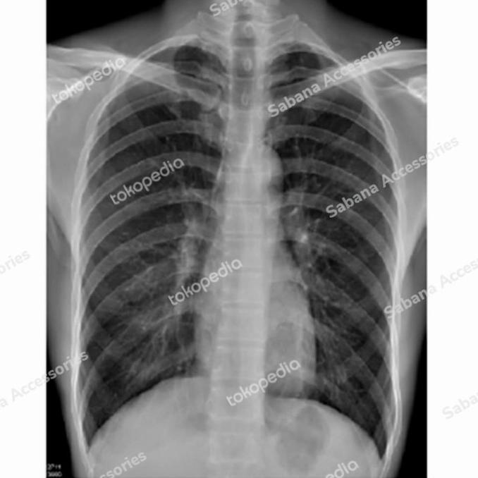 Jual Medical Dry Film Radiology (Blue Inkjet Film), Ukuran A4 | Shopee ...