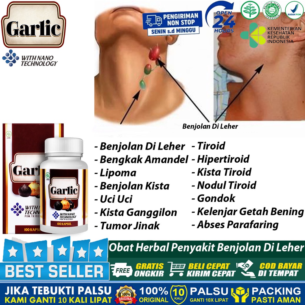 Jual Obat Benjolan Di Leher Lipoma Kista Ganggilon Gondok Tiroid ...