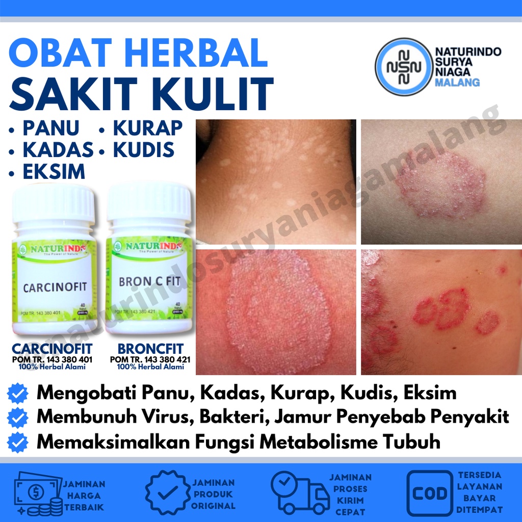 Jual Obat Panu Obat Gatal Paling Ampuh Obat Gatal Kulit Obat Kurap ...
