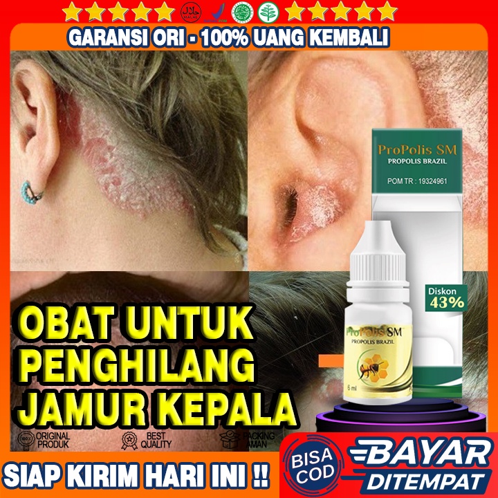 Jual Obat Jamur Di Kepala, Obat Kulit Kepala Borok, Obat Kulit Kepala Berjamur, Obat Kulit ...