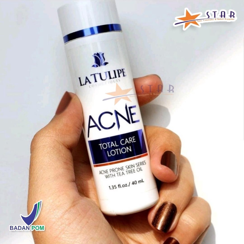 Jual STAR La Tulipe Acne Total Care Lotion / Obat Jerawat | Shopee ...
