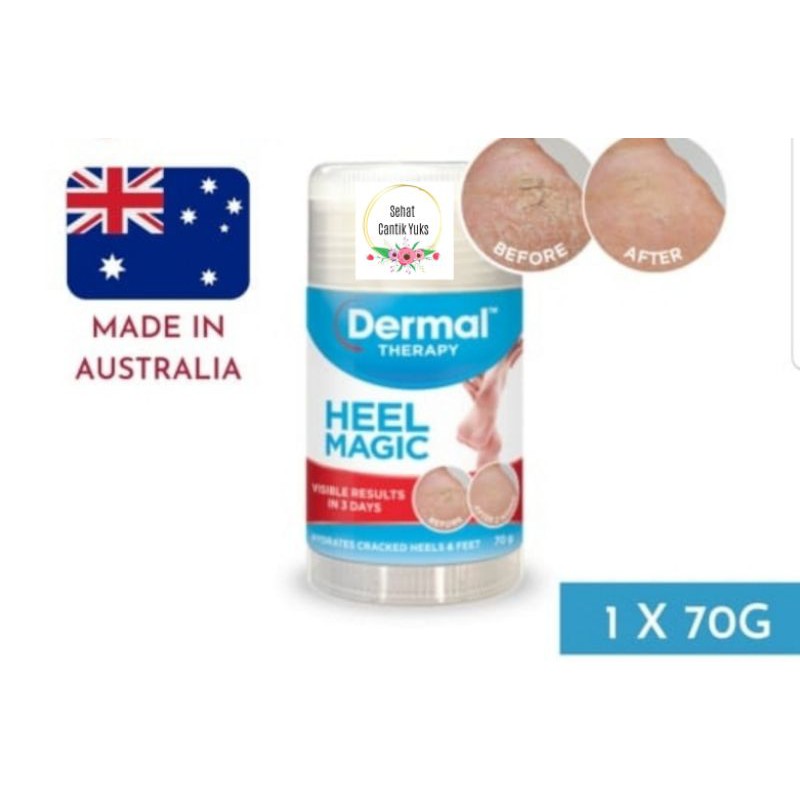 Jual Dermal Heel Magic 70 Gr | Shopee Indonesia