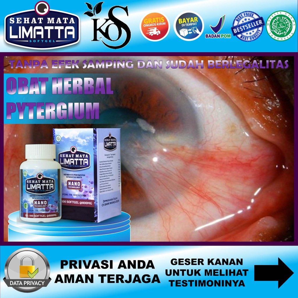 Jual Obat Mata Pytergium Mata Berlemak Obat Lemak Mata Obat Herbal Mata Berlemak Obat Pterigium ...