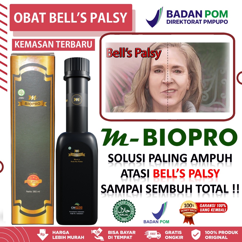 Jual Obat Bells Palsy, Bells Palsy, Bibir Mencong, Lumpuh Sebelah, Obat ...