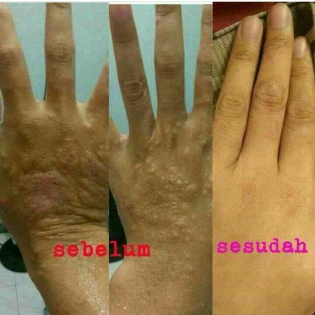 Jual Minya bulus putih | Shopee Indonesia