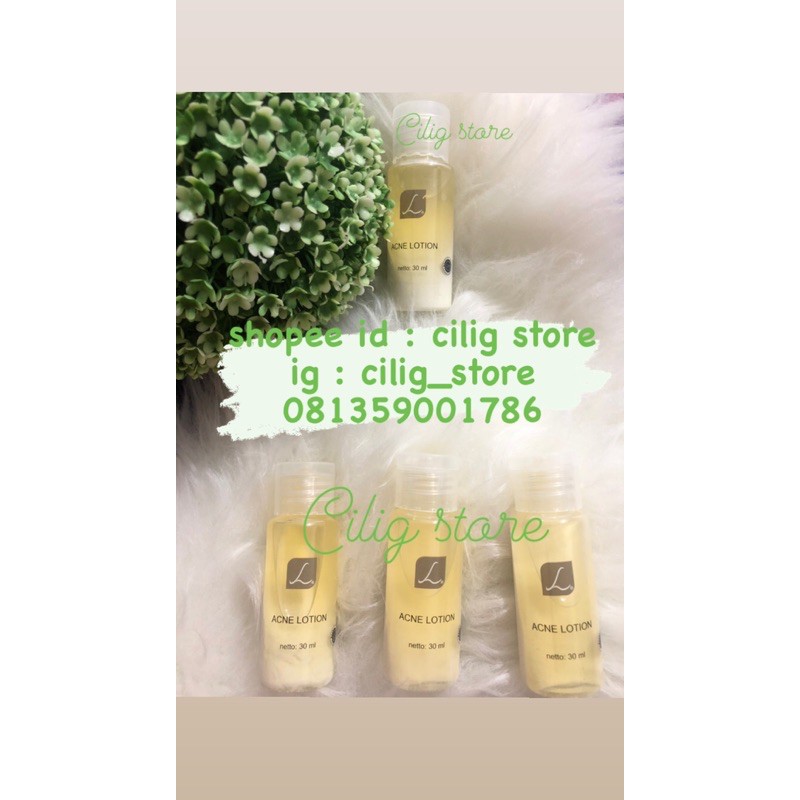 Jual Larissa Acne Lotion READY FREE FULL BUBLEWRAP | Shopee Indonesia
