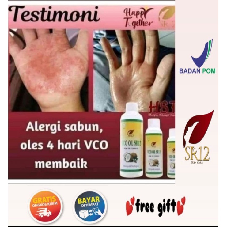 Jual VCO SR12 | VICO ASLI | MINYAK KELAPA MURNI | VICO OBAT GATAL | VCO ...