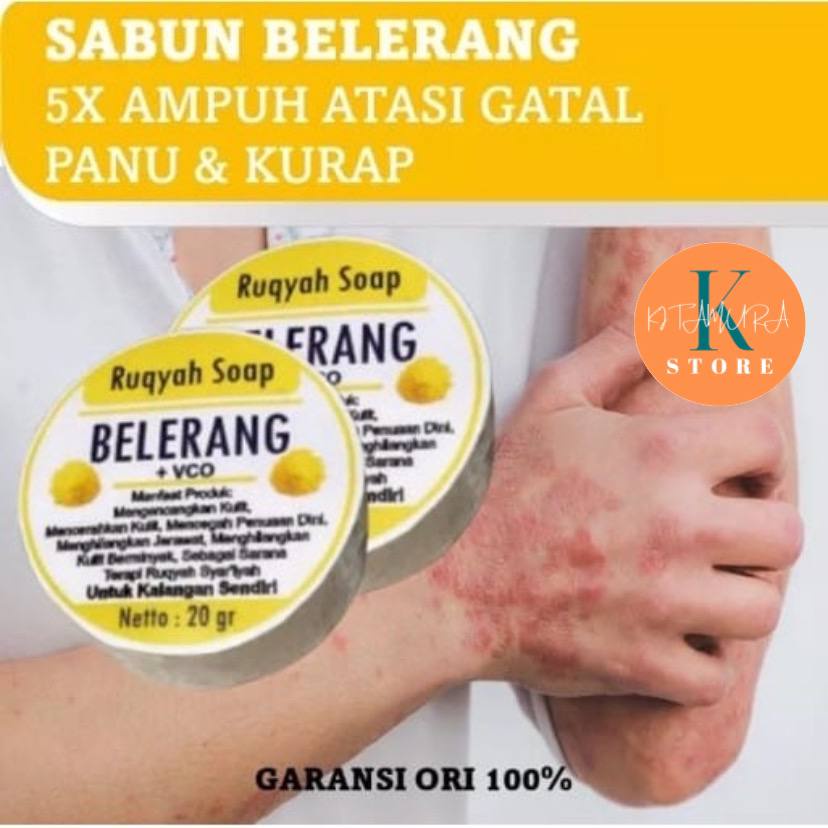 Jual Sabun gatal kulit paling ampuh Sabun belerang untuk gatal asli ...