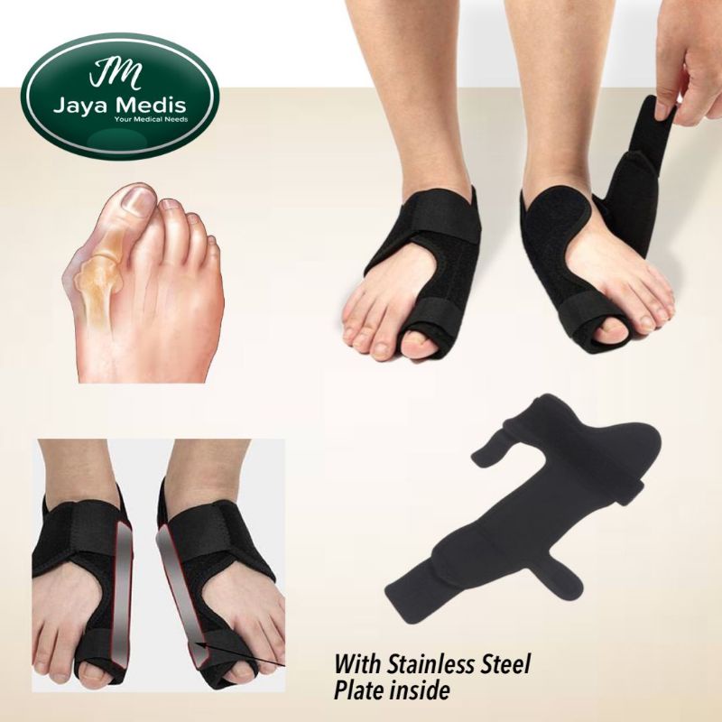 Jual Korektor Bunion Belat Pelurus Kaki Brace Hallux Valgus - 2pcs ...