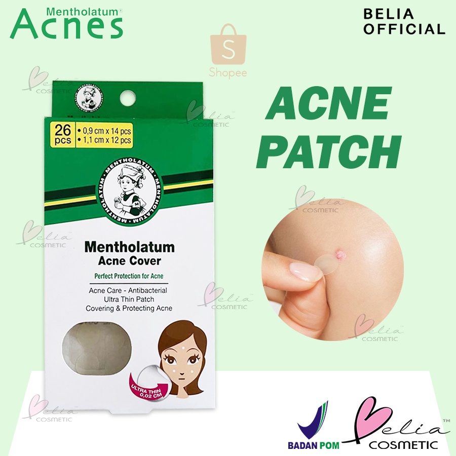 Jual BELIA ACNES Mentholatum Acne Cover 26 pcs 0.9 cm | 1.1 cm | Acne ...