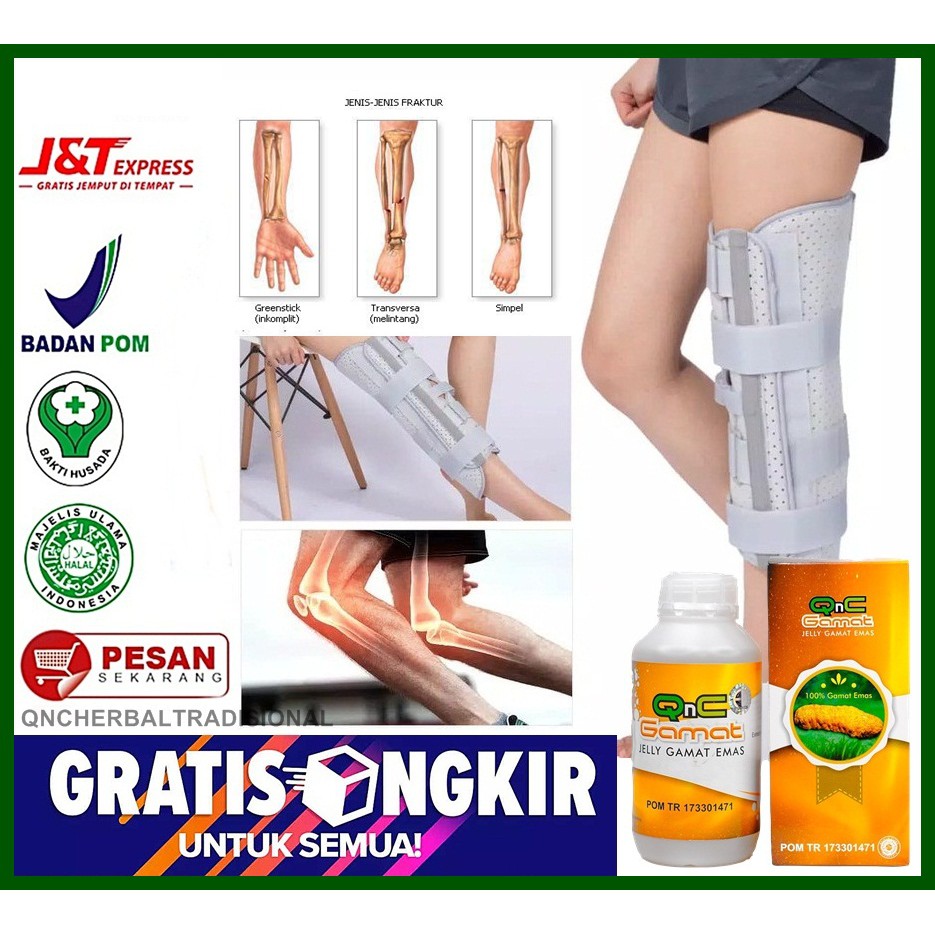 Jual Obat Herbal Patah Tulang, Tulang Retak, Remuk, Fraktur Tulang ...