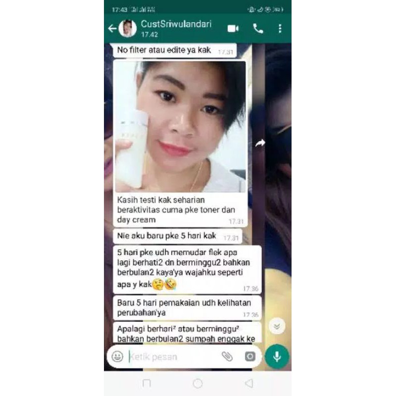 Jual cream flek glow flek tipis rujak incess | Shopee Indonesia