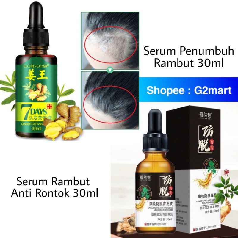 Jual Serum Anti Rontok Zhi Ran Mei Cairan Essence Penumbuh Rambut ...