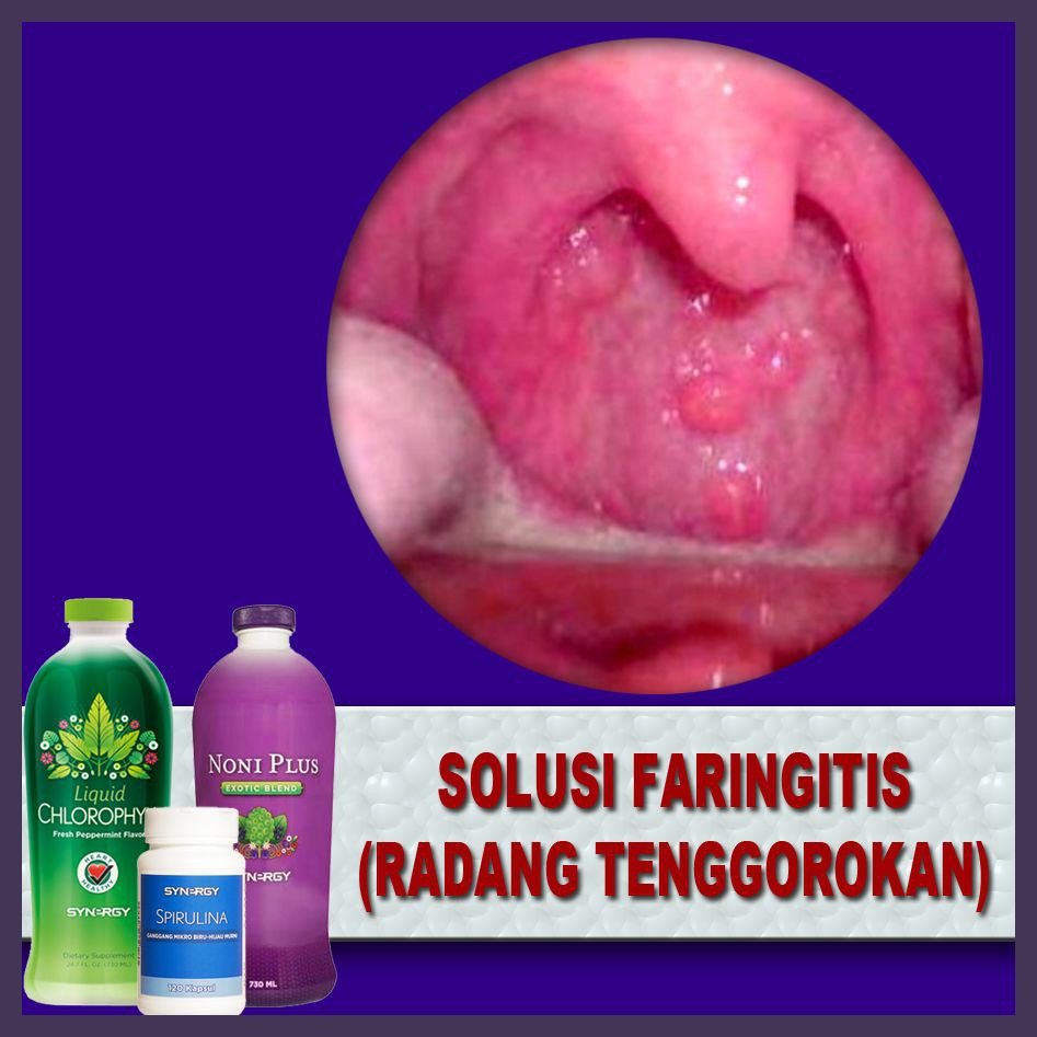 Jual Obat Herbal MaxiPack Radang Tenggorokan Faringitis Dan Demam Nyeri ...