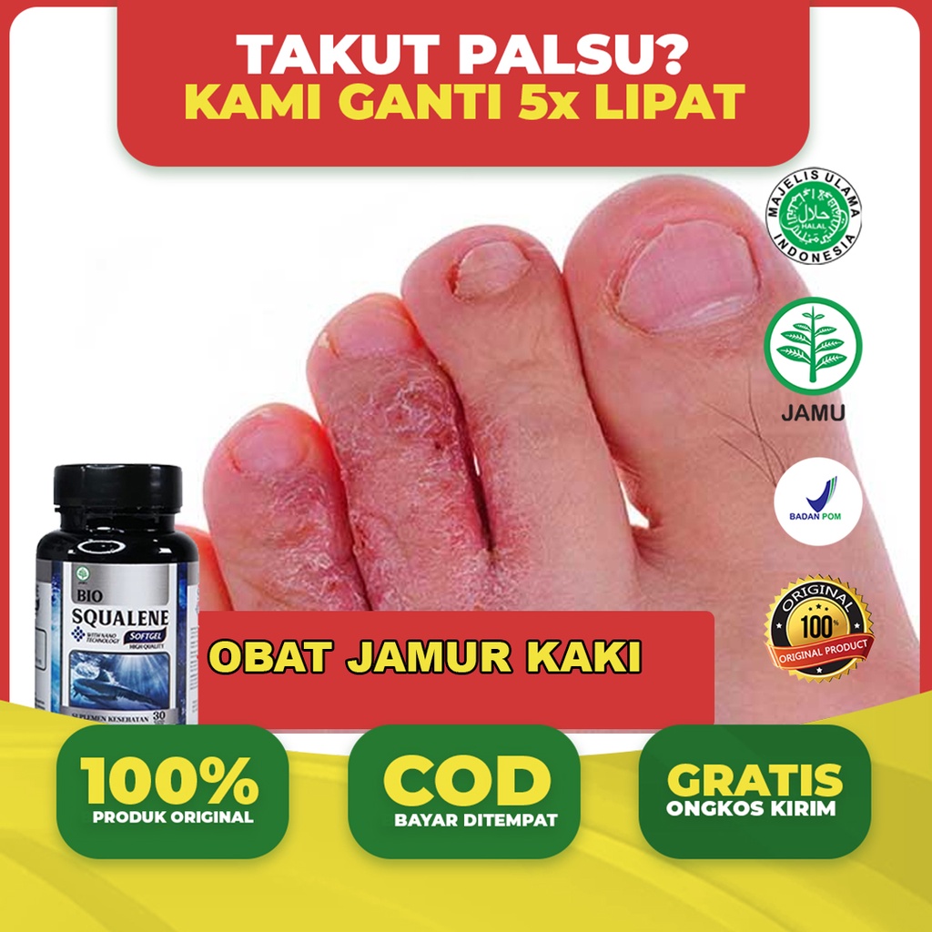 Jual Obat Jamur Kaki - Infeksi Jamur Pada Kaki - Obat Telapak Kaki Bau ... Jual Obat Jamur Kaki - Infeksi Jamur Pada Kaki - Obat Telapak Kaki Bau ...