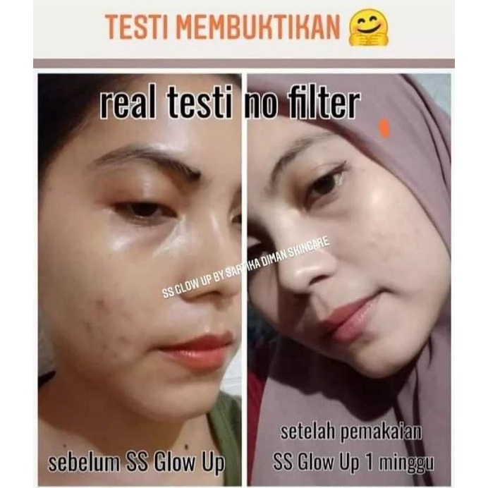 Jual SS glow series | Shopee Indonesia
