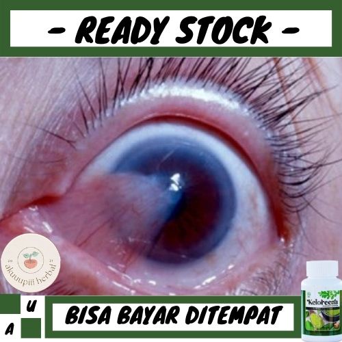 Jual Obat Mata Berlemak, Obat Untuk Mata Berlemak, Obat Mata Ada ... Jual Obat Mata Berlemak, Obat Untuk Mata Berlemak, Obat Mata Ada ...