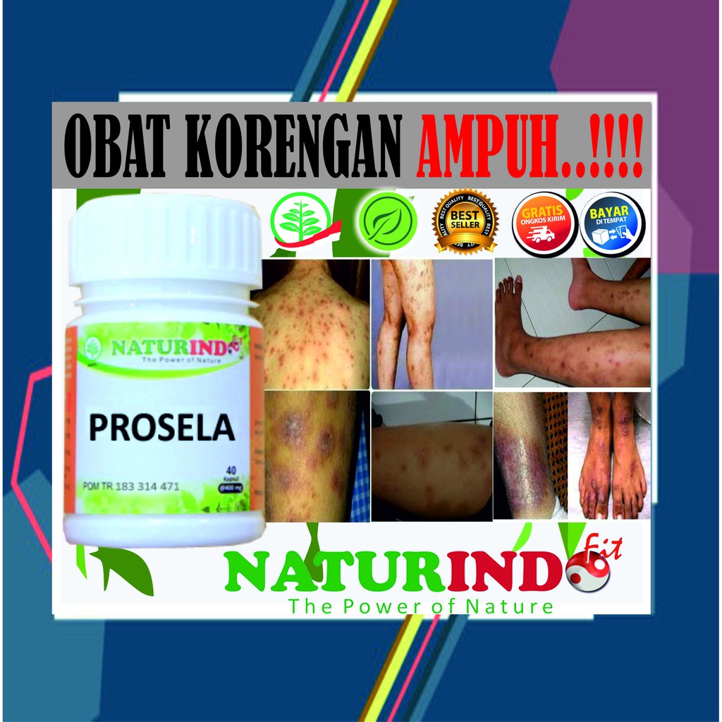 Jual OBAT KORENG KULIT MENGHITAM PENGHILANG BEKAS LUKA KORENGAN GATAL ...