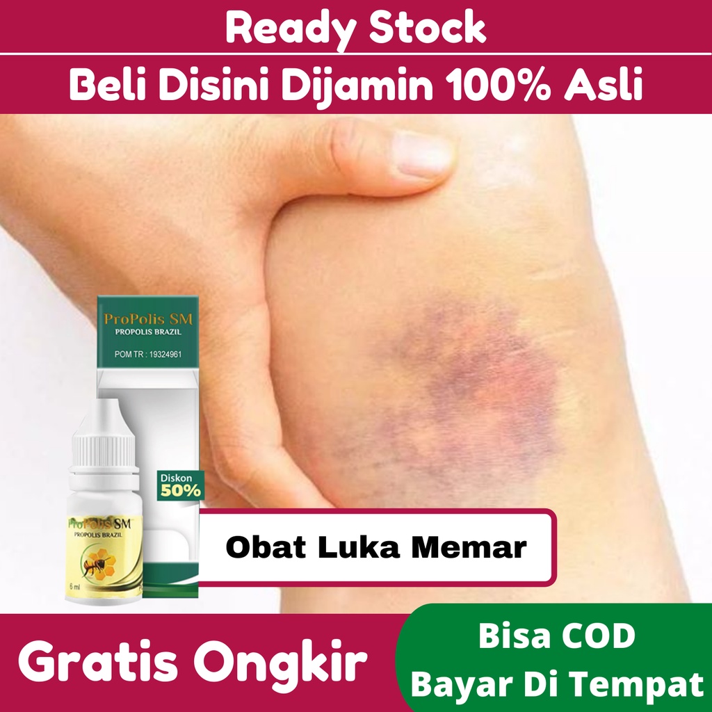 Jual Obat Luka Memar , Luka Jatuh , Obat Luka Koreng , Obat Ruam Merah ...