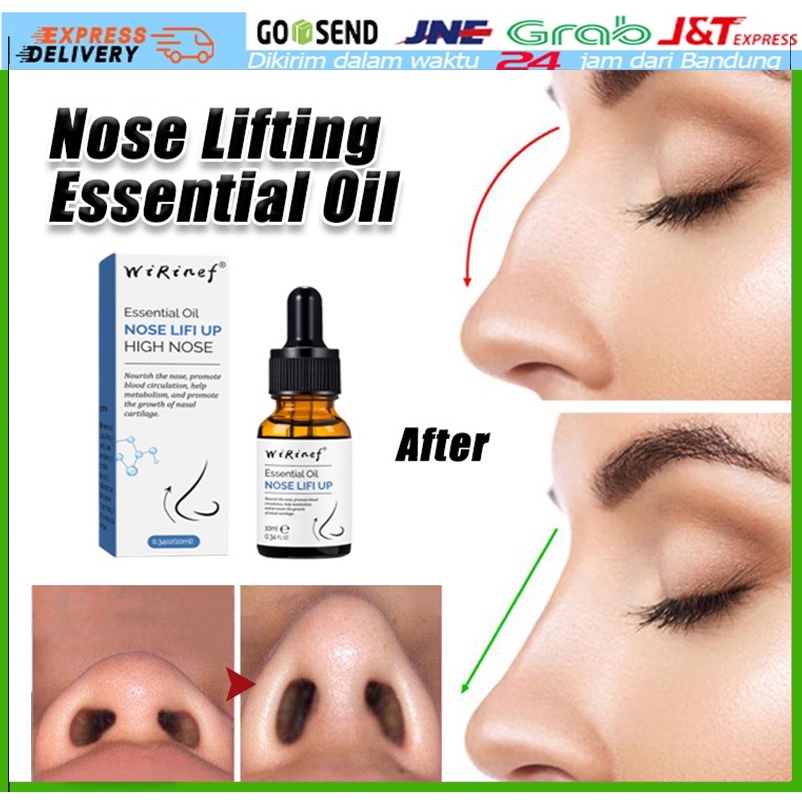 Jual EGOT - alat hidung pemancung hidung alat pemancung hidung 10ml ...