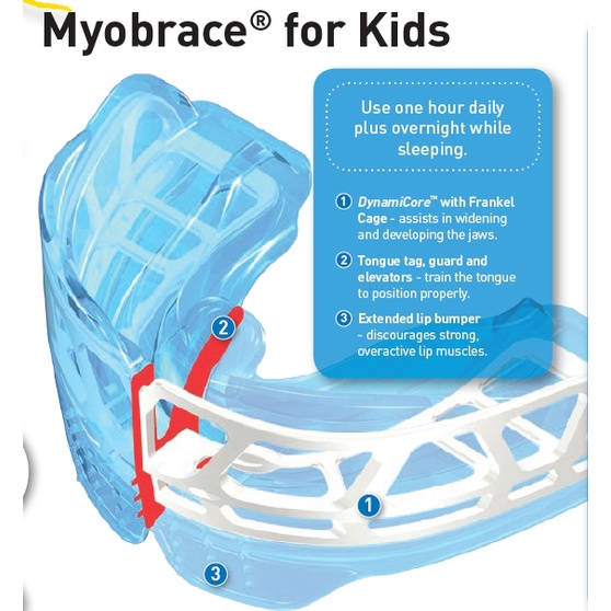 Jual MYOBRACE for KID 6-10 TH / MYOFUCTIONAL ORTHODONTICS/ TRAINER GIGI ...