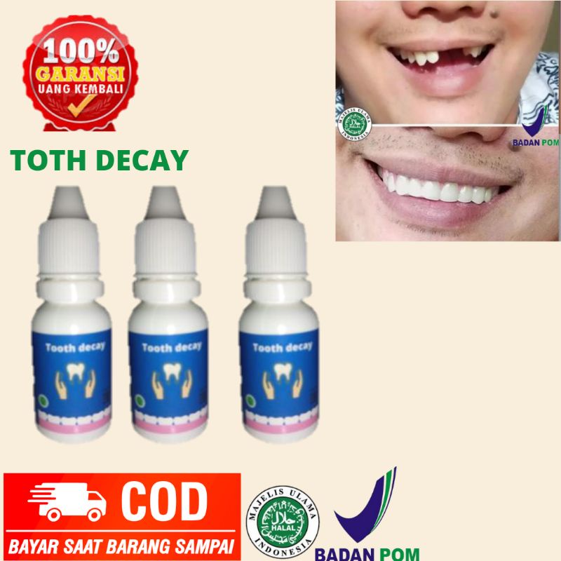 Jual PENUMBUH GIGI 100% AMPUH, OMPONG, KROPOS, BERLUBANG, PATAH, SEMUA ...