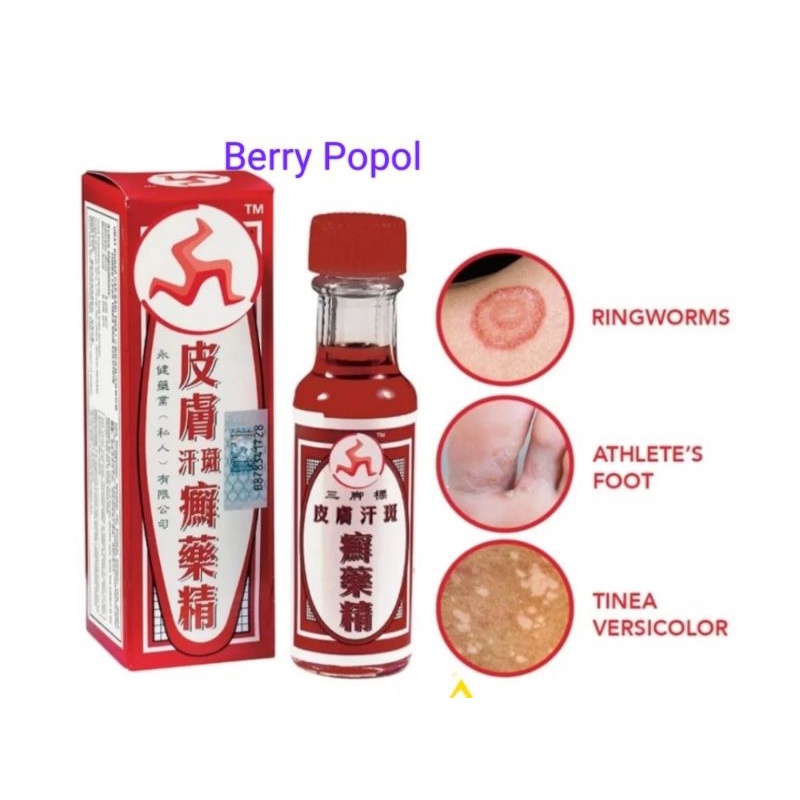 Jual Obat kurap cap kaki tiga / ubat kurap cap kaki tiga in untuk panu ...